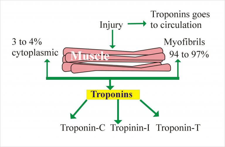 What is Normal Troponin Level : Reference Range and Interpretation