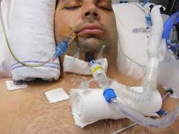 How Do You Know When it is Time to Extubate?