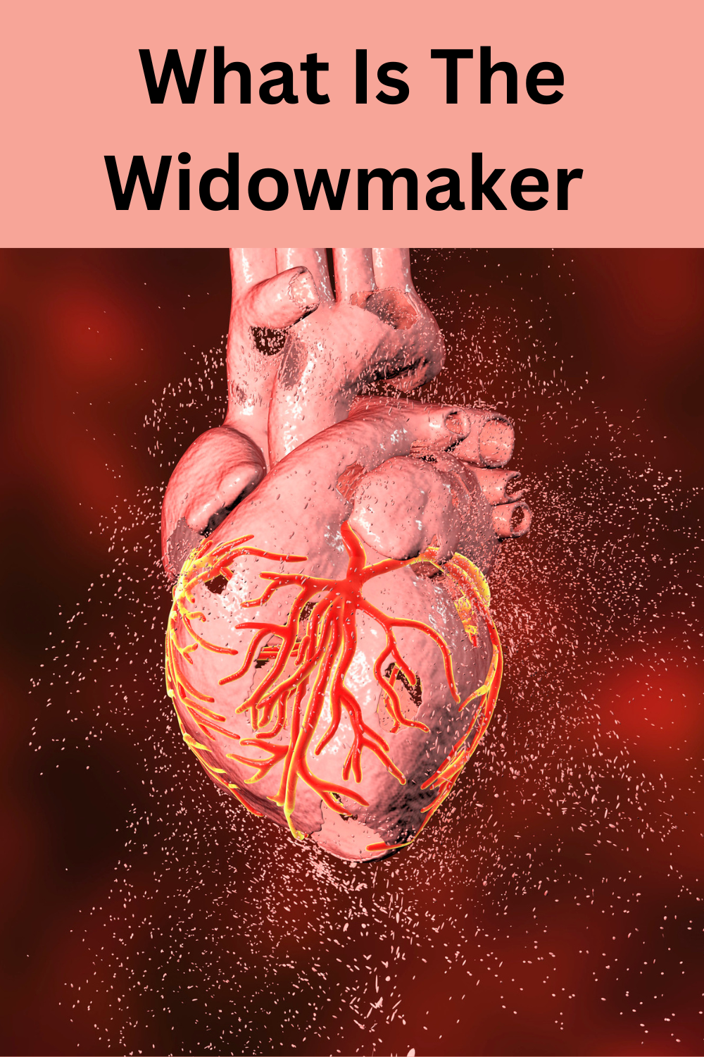 Widowmaker Heart Attack Facts | Healing Heart Disease Naturally (HHDN)